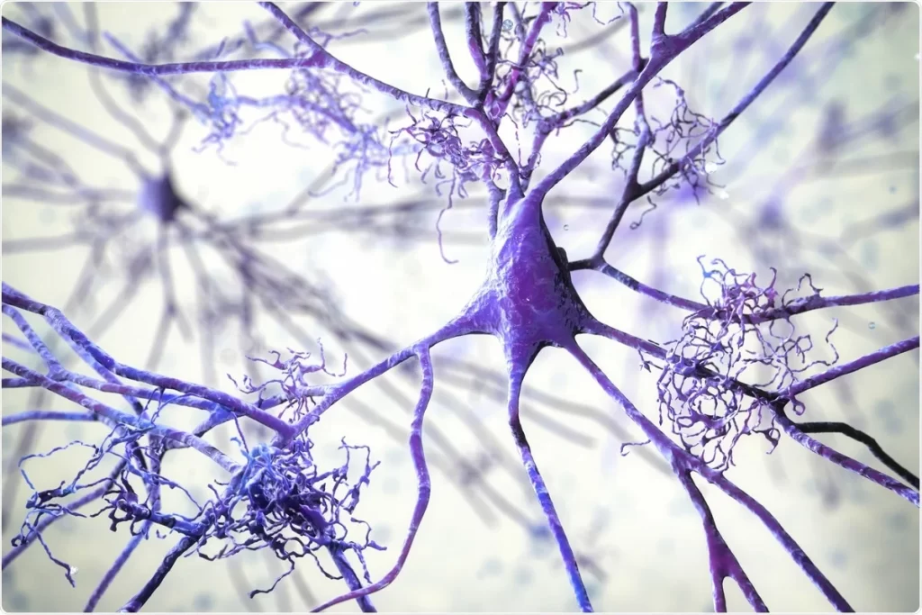 β-amyloid and Alzheimer’s Disease | LifeTein Peptide Blog